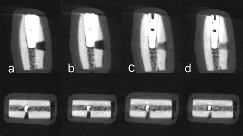 Sagittal And Axial Images With Simulated Peri Implant Fenestration Download Scientific Diagram