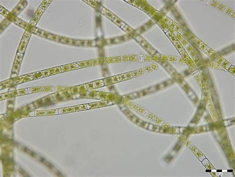 Information Of Zygnema