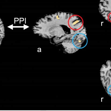 The Results Of A Whole Brain Analysis Examining Where In The Brain