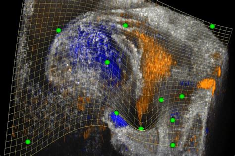 Software Tool Provides A New View Inside Complex 3d Biomedical Images