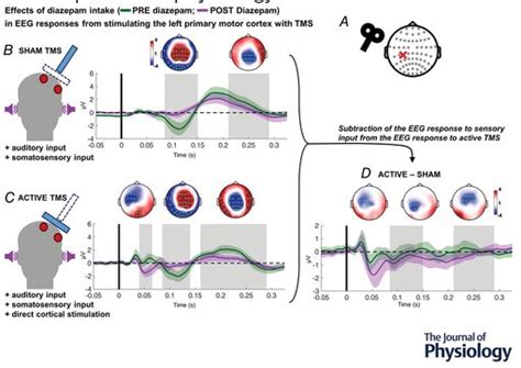 Tms Eeg Tms Vs Sensory Input Jali Medical Inc Posted On The Topic Linkedin