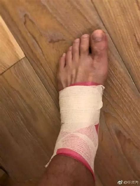 任賢齊爆肥後拼命健身，顏值瘦回巔峰腳卻受傷了 每日頭條