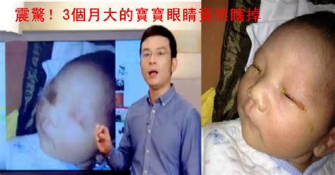 震驚！！3個月大的寶寶眼睛竟然瞎掉，全因家長的朋友一時忘記關掉