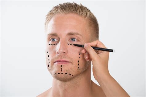 Man With Correction Mark For Plastic Surgery Stock Image Image Of