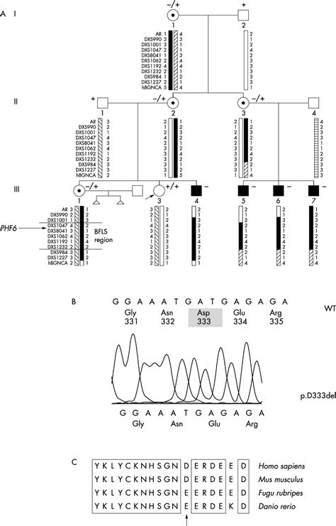 Figure 1 From Novel Phf6 Mutation Pd333del Causes Börjeson Forssman