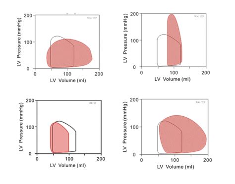 Pressure Volume Loops Valvular Problems Quiz