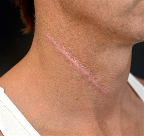 Face Knife Good Times With Scar At Michael Dalrymple Blog