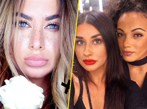 Photos Fausses Taches De Rousseur La Nouvelle Tendance Beauté