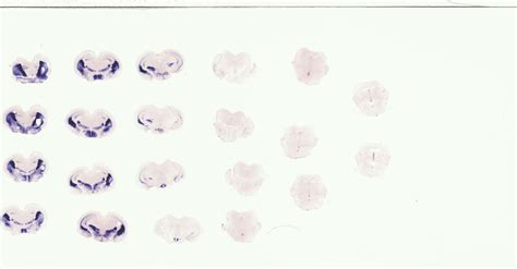 Dlx5 Rna In Situ Gene Expression Assay Gxd