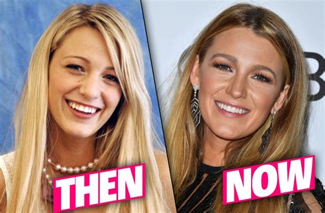 Blake Livelys Nose Job Rumors Secret High School Photos Uncovered