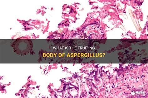 What Is The Fruiting Body Of Aspergillus Medshun
