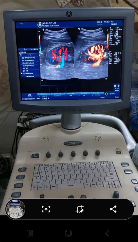 Siemens Ultrasound Machines At ₹ 399998 Fraser Road Patna Id