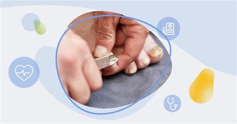 【灰甲】初期症狀、成因、治療及預防方法 Avo 保險