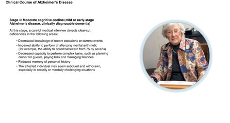 Alzheimersdiseasediagnosticcriteria