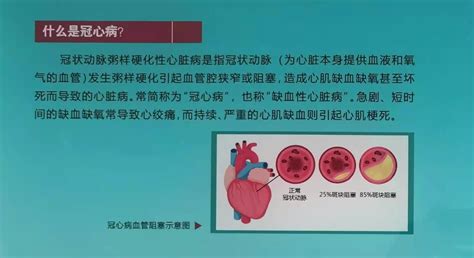 药物涂层球囊一种介入无植入的冠脉狭窄解决方案 春雨医生