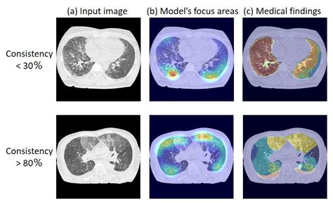 Research Validates Deep Learning Models For Drowning Diagnosis Mirage