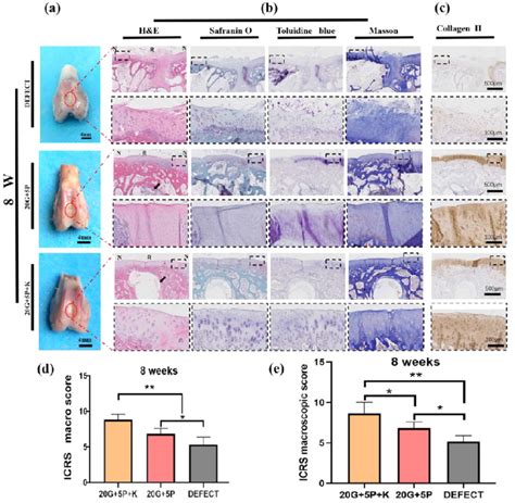 Injectable Gelmapedga Hydrogel Cartilage Scaffolds Restore