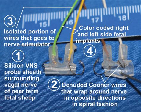 Design Of The Vagus Nerve Stimulation Probe A Silicon Tube Of 317
