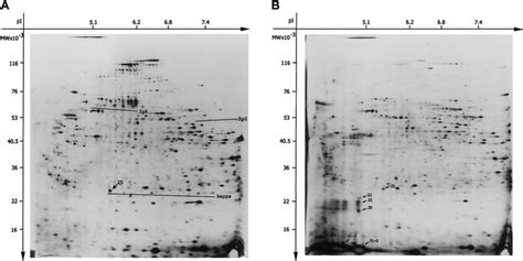The 2 De Of The Soluble And Membrane Bound Protein Fractions From The