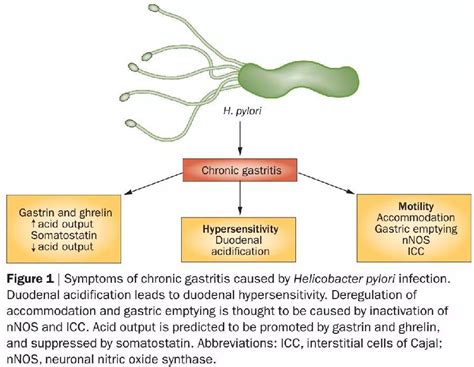 第五次全国幽门螺杆菌感染处理共识报告热点解读 搜狐大视野 搜狐新闻