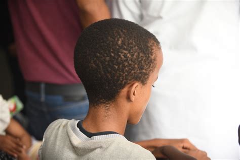 ¿qué Es La Hidrocefalia Y Cuáles Son Sus Causas