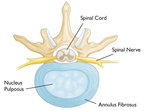 Cervical Spondylosis Arthritis Of The Neck Orthoinfo Aaos