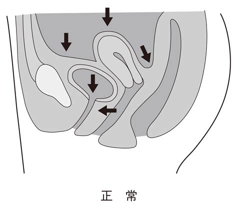 98H53 更年期 国試 M3E Medical