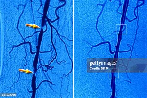 Transluminal Photos And Premium High Res Pictures Getty Images