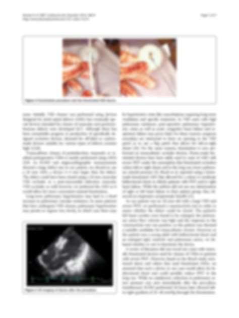 Solution Percutaneous Closure Of Large Vsd Using A Home Made