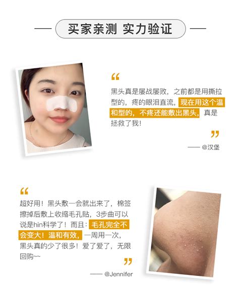 韩国rnw去黑头鼻贴粉刺闭口控油收缩毛孔镇静温和清洁拍下惊喜价虎窝淘