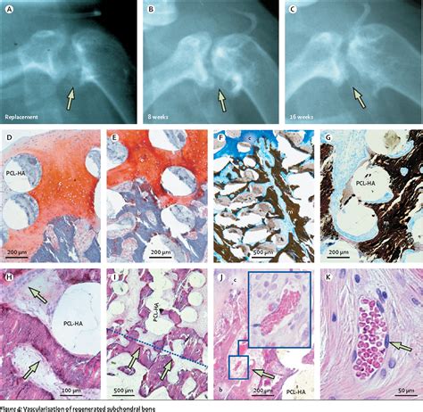 Synovial Joint Structure Semantic Scholar