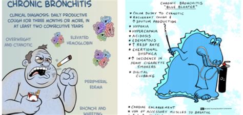 N413 Gas Exchange Practice Questions Flashcards Quizlet