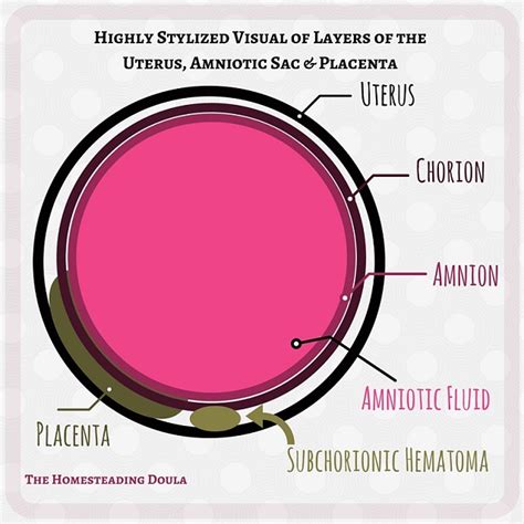 Subchorionic Hematoma Layers Food And Nutrition Website