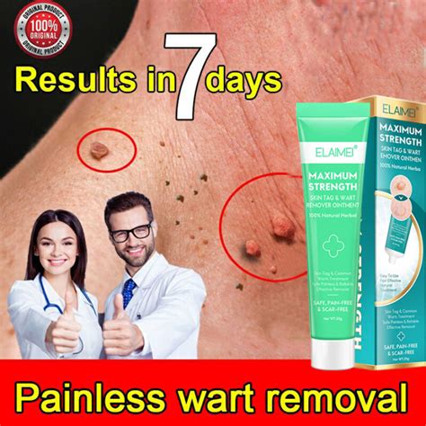 20g Elaimei Warts Remover Original Cream Remover Wart Ointment Original