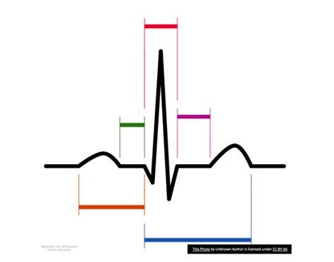 Ekg Wave Parts Quiz