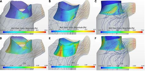 Ac Wall Shear Stress Wss Displayed On The Device Frame For Cases