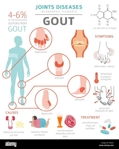 Joints Diseases Gout Symptoms Treatment Icon Set Vect