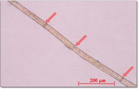 Optical Microscope Image Displaying Distinctive Nodes On Fibers