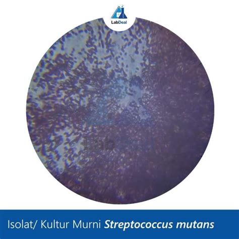 Jual Kultur Mikroorganisme Streptococcus Mutans Dalam Media Agar Di Seller Agavilab Padasuka