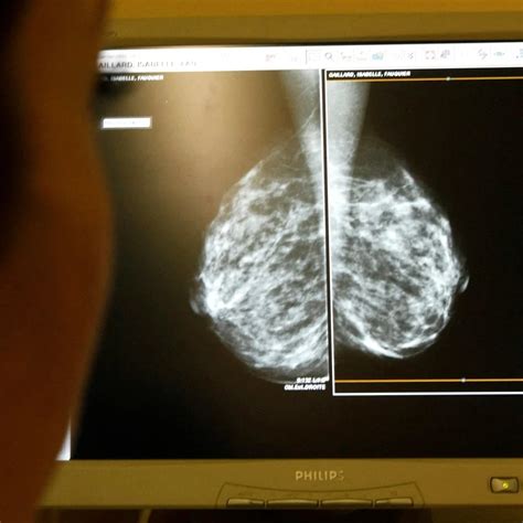 Vino Argentino Centolla Patagónica Y Trucha De Lago Las Delicias