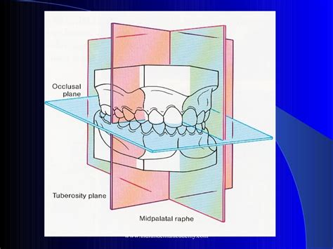 Malocclusion Classification Certified Fixed Orthodontic Courses
