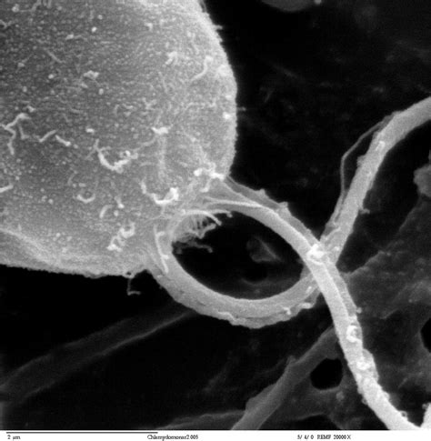 Scanning Electron Microscope Image Showing An Example Of Green Algae