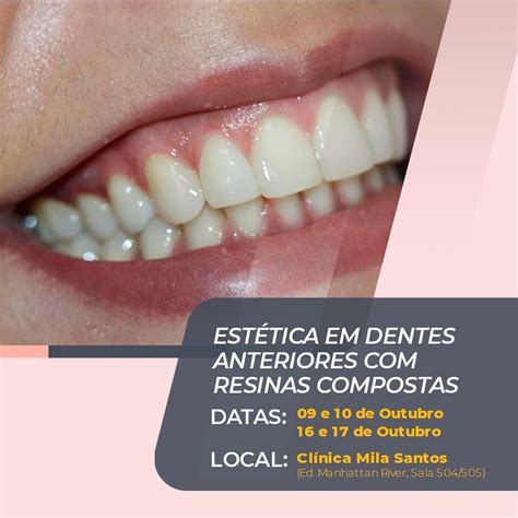Venha Conosco Vivenciar 2 Dias De Clínica Mila Santos Facebook