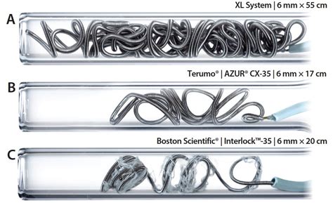 A New Class Of Coil Introducing The Ruby® Xl System Endovascular Today