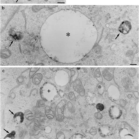 The Effects Of Wortmannin On Inward Vesiculation In Cells Where The