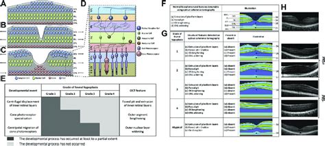 Foveal Pit Formation And Movement Of Retinal Cells During Formation Of