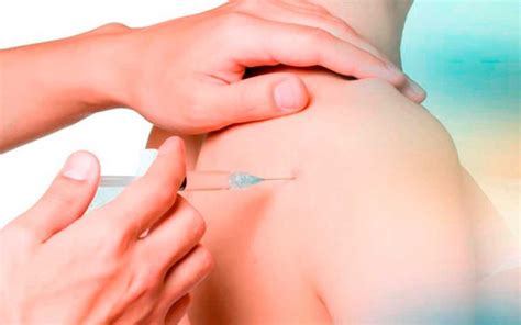 El vínculo existente entre la terapia neural y la acupuntura Elaesi