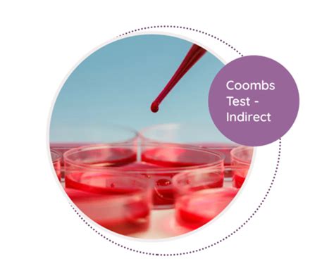 Coombs Test Mediscan Lab