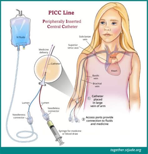 How To Administer Iv Antibiotics Through A Picc Line