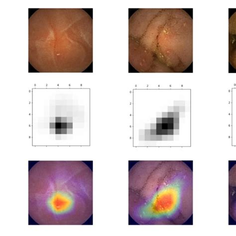 Convolutional Neural Networks CNN Are A Sub Type Of Artificial Download Scientific Diagram
